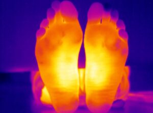 Understanding Neuropathy and the Power of Thermal Imaging Scans – Blue ...